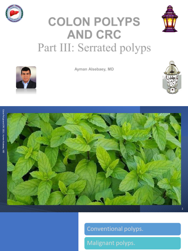 Colon Polyps and CRC Part III Serrated Polyp 2021 | PDF | Colorectal ...