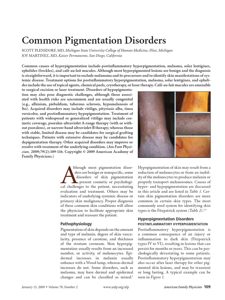 AAFP Common Pigmentation Disorders | PDF