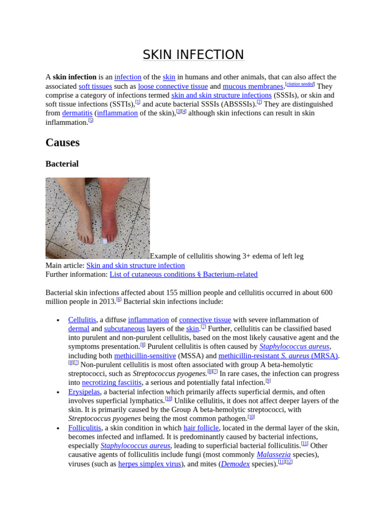 Skin Infection By Azan Afzal Pdf