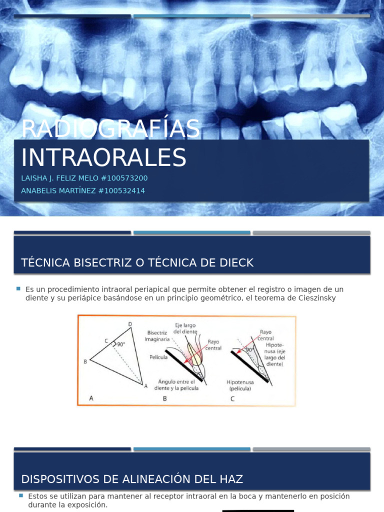 Radiografías Intraorales 2 | PDF