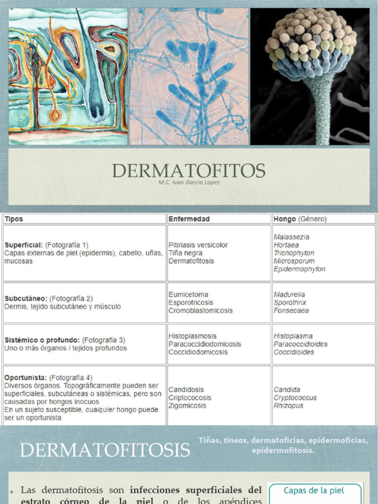 3.1 Dermatofitosis | PDF