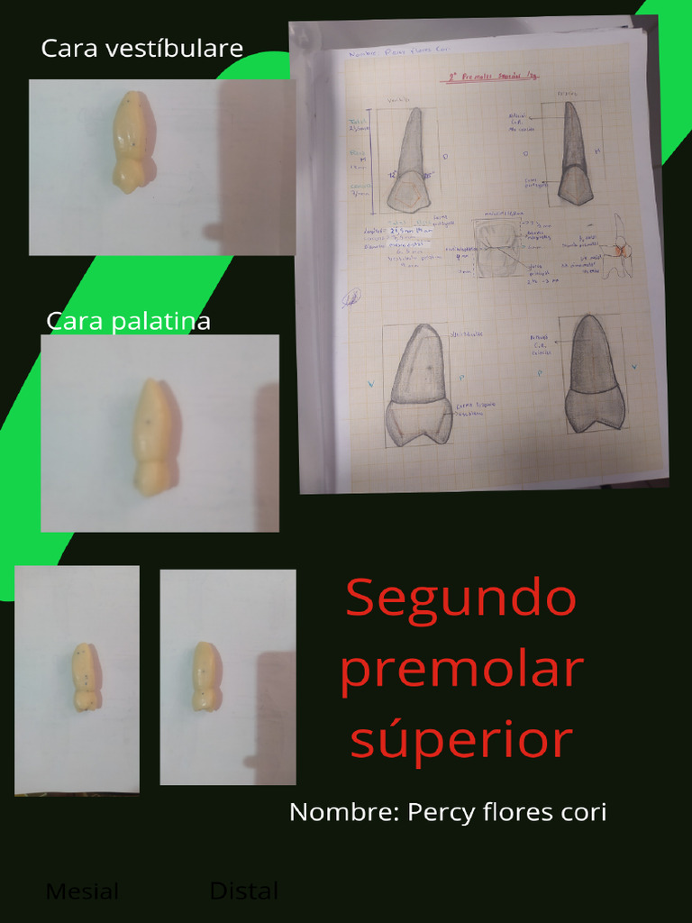 Segundo Premolar Superior | PDF