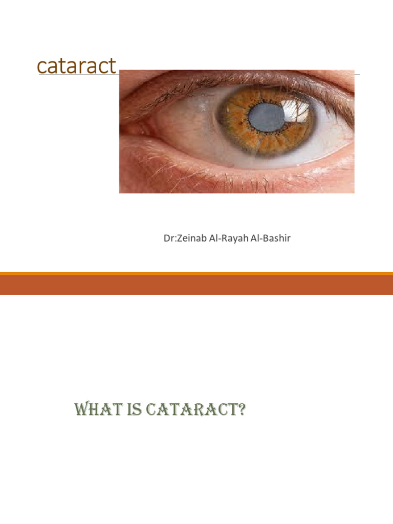 5- Cataract | PDF