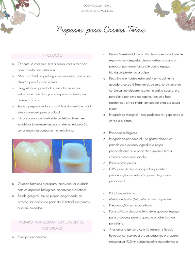 Preparo Protético | PDF