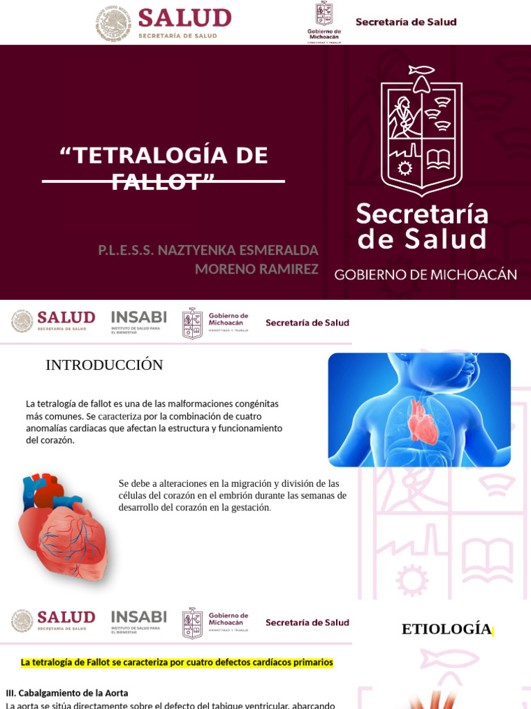 Tetralogia de Fallot - Expo Hosp. de La Mujer | PDF