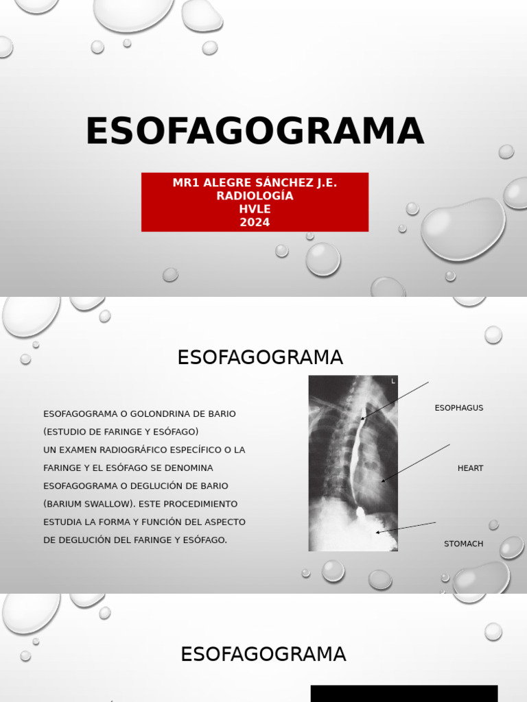 Esofagograma | PDF