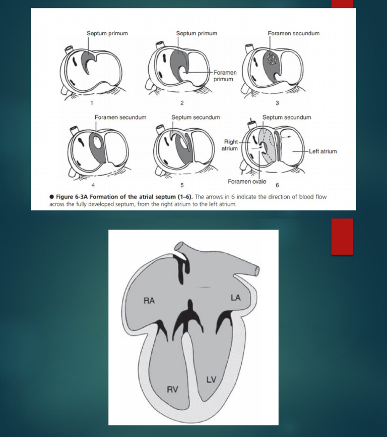 PFO | PDF