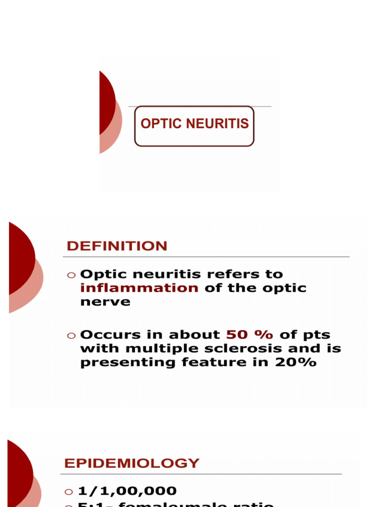 Optic Neuritis | PDF