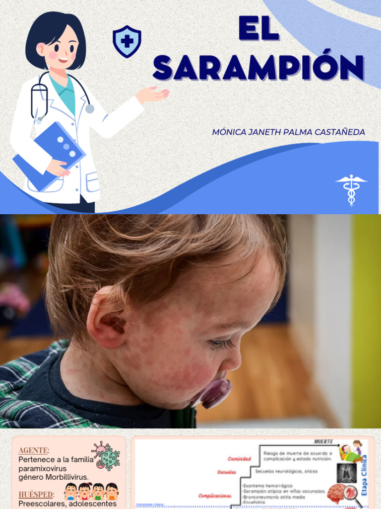 El Sarampion | PDF | Sarampión | Ciencia y matemáticas