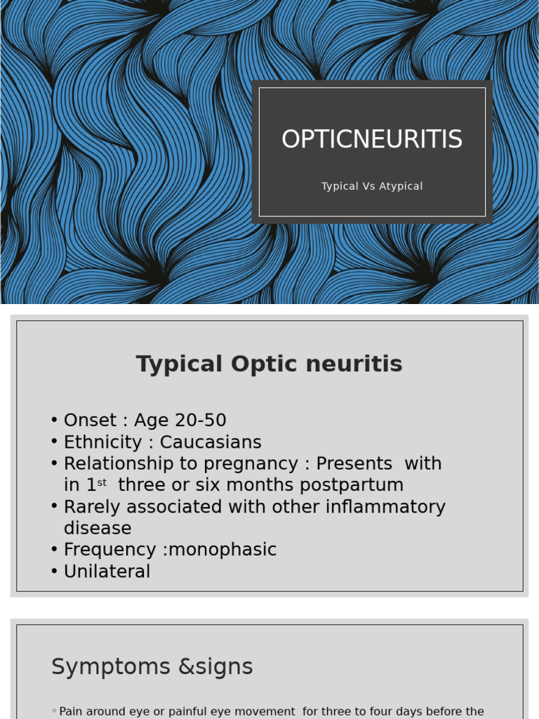 Typical Vs Atypical Optic Neuritis | PDF