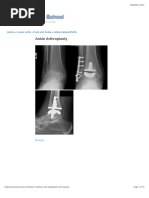 PROPHECY INBONE Surgical Technique | PDF | Ct Scan | Medical Imaging