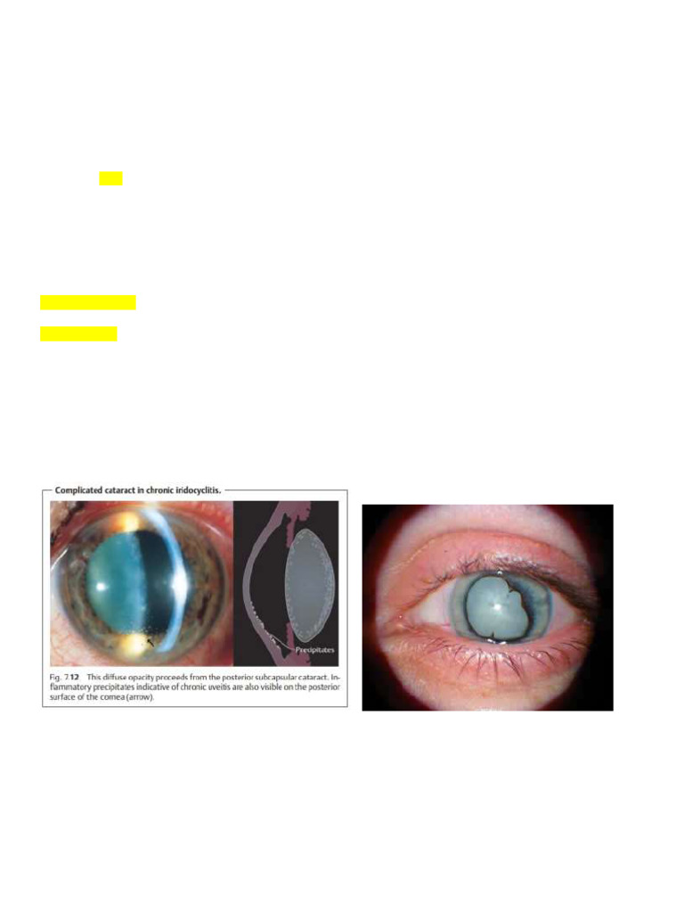 9) Chronic Iridocyclitis | PDF