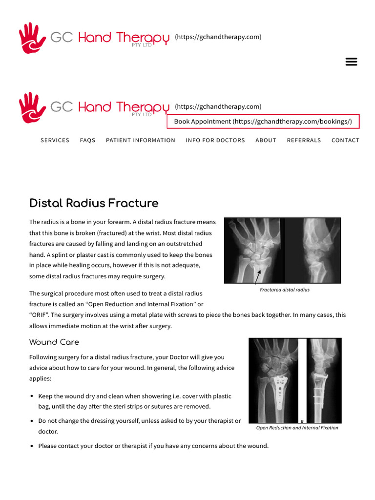 Distal Radius Fracture - GC Hand Therapy | PDF