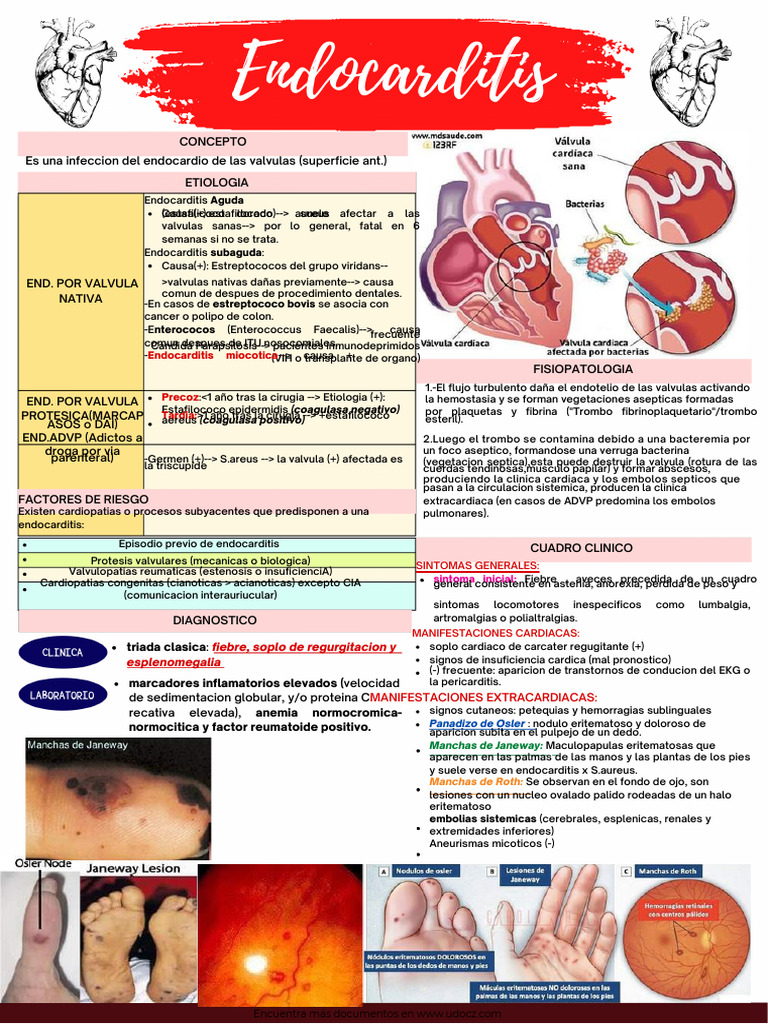 Endocarditis (Wilmer Contreras) | PDF