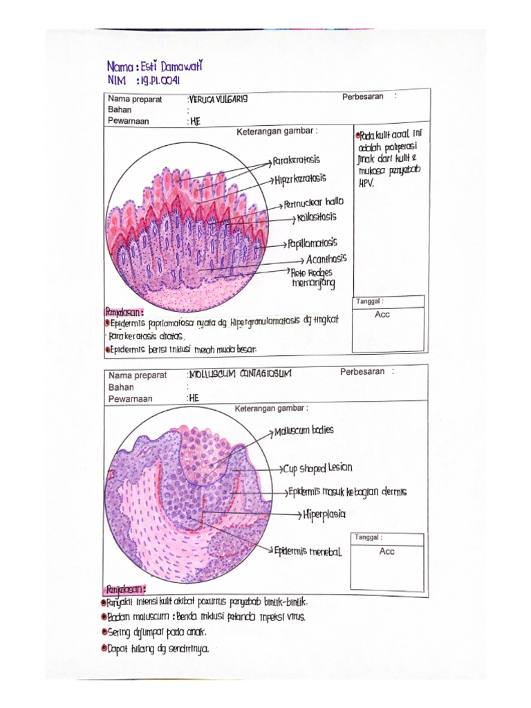 Esti-PA 4.2-19P10041 | PDF