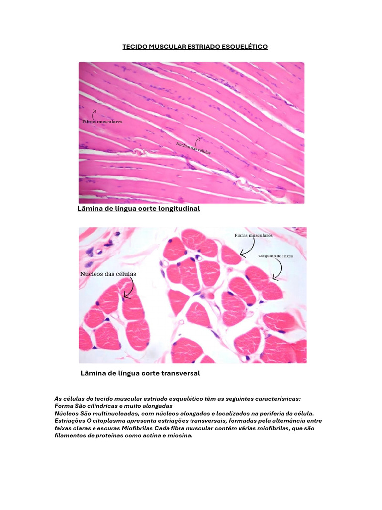 Tecido Muscular Estriado Esquelético: Lâmina de Língua Corte ...