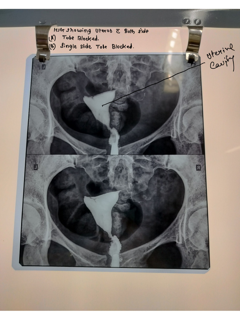 USG (Obs & Gyn) - 1 | PDF