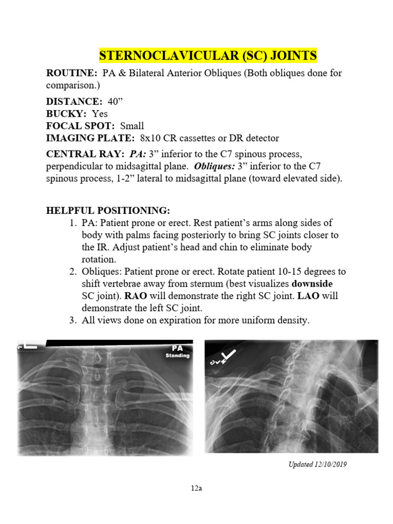 Imaging Protocol XR Thorax Sterno Clavicular Joints | PDF