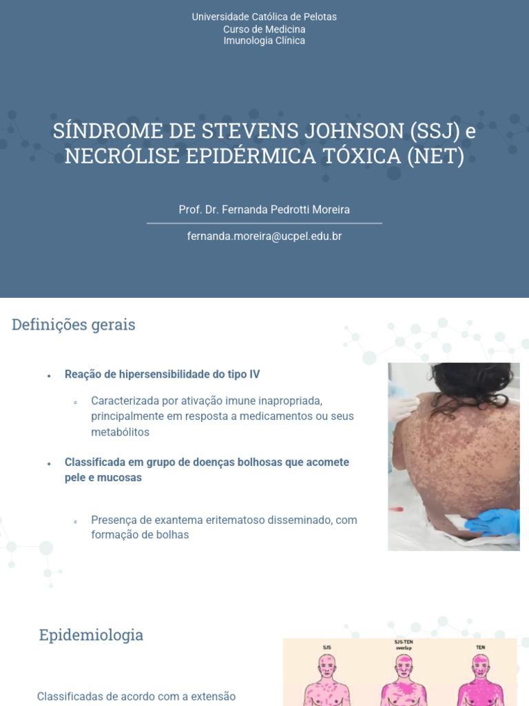 Síndrome de Stevens Johnson (SSJ) E Necrólise Epidérmica Tóxica (Net) | PDF