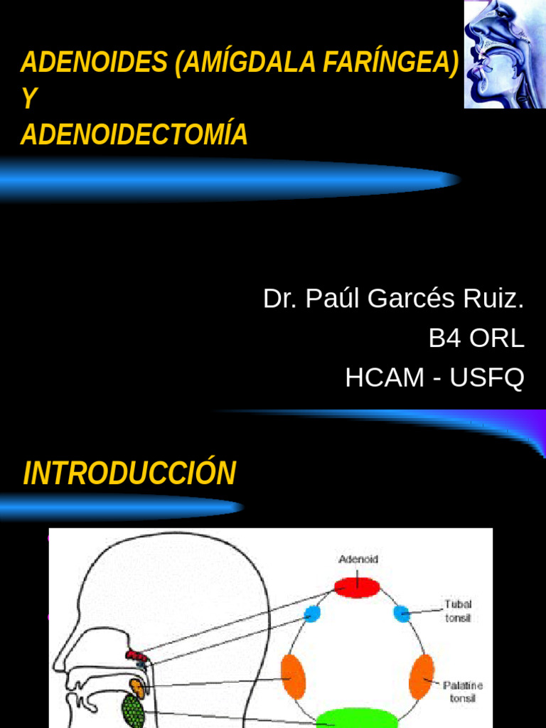 Adenoides Adenoidectomia | PDF | Medicina CLINICA | Especialidades Medicas