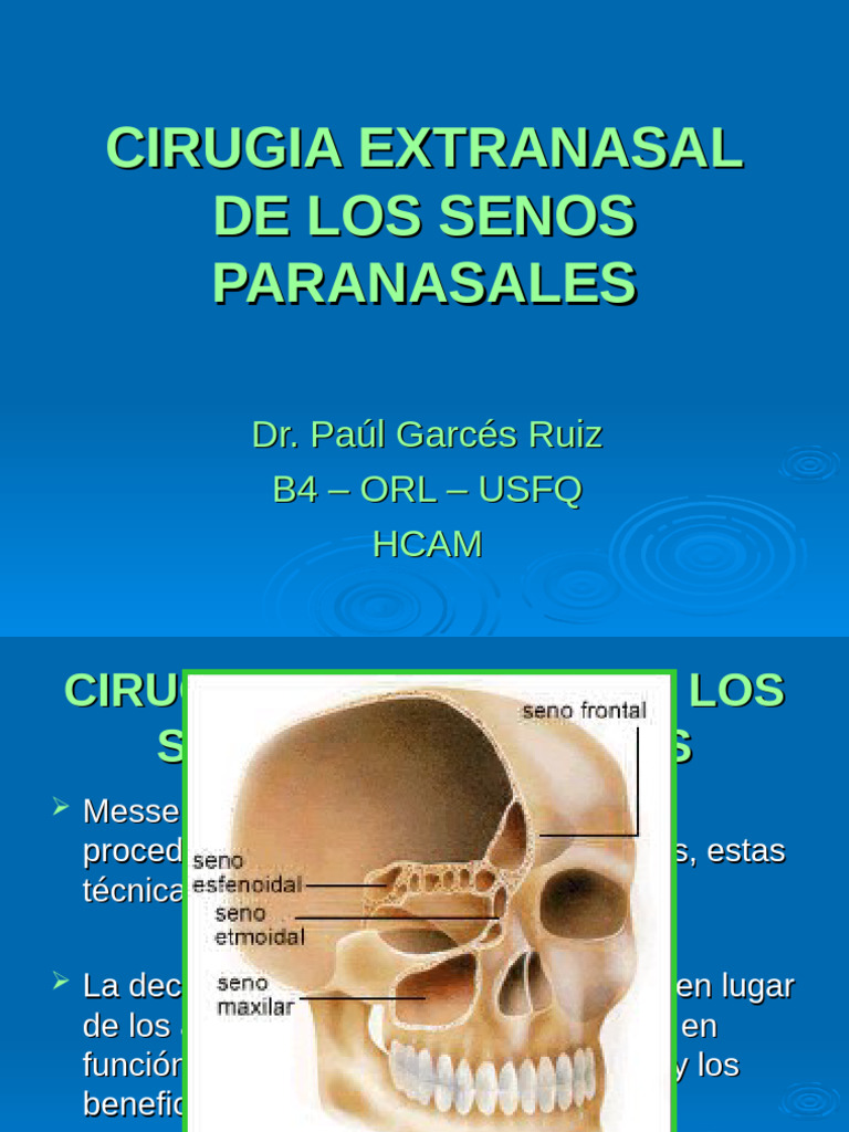 Cirugia Extranasal Senos Paranasales | PDF