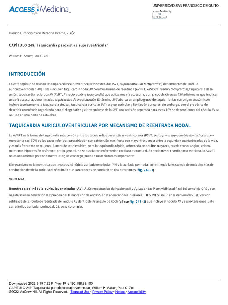 CAPÍTULO 249 - Taquicardia Paroxística Supraventricular | PDF