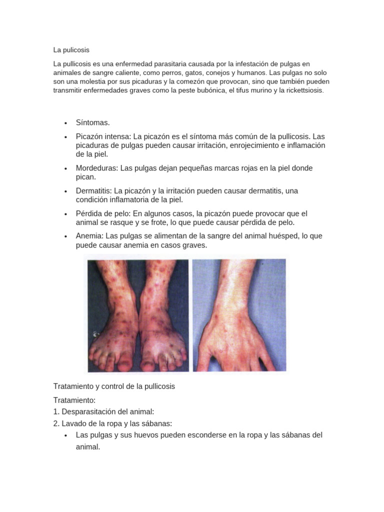 La Pulicosis | PDF