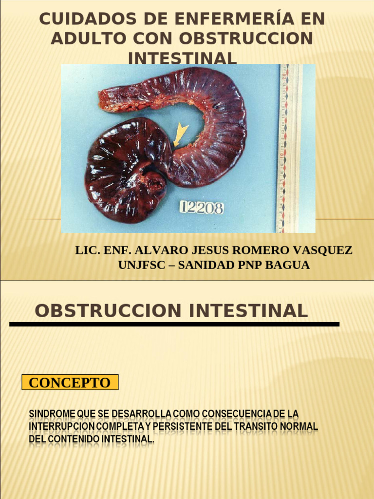 Obstruccion Intestinal | PDF
