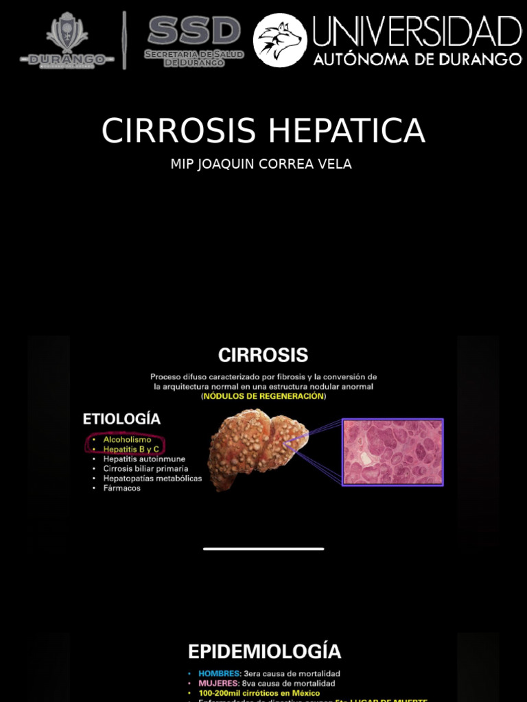 Cirrosis Hepatica | PDF