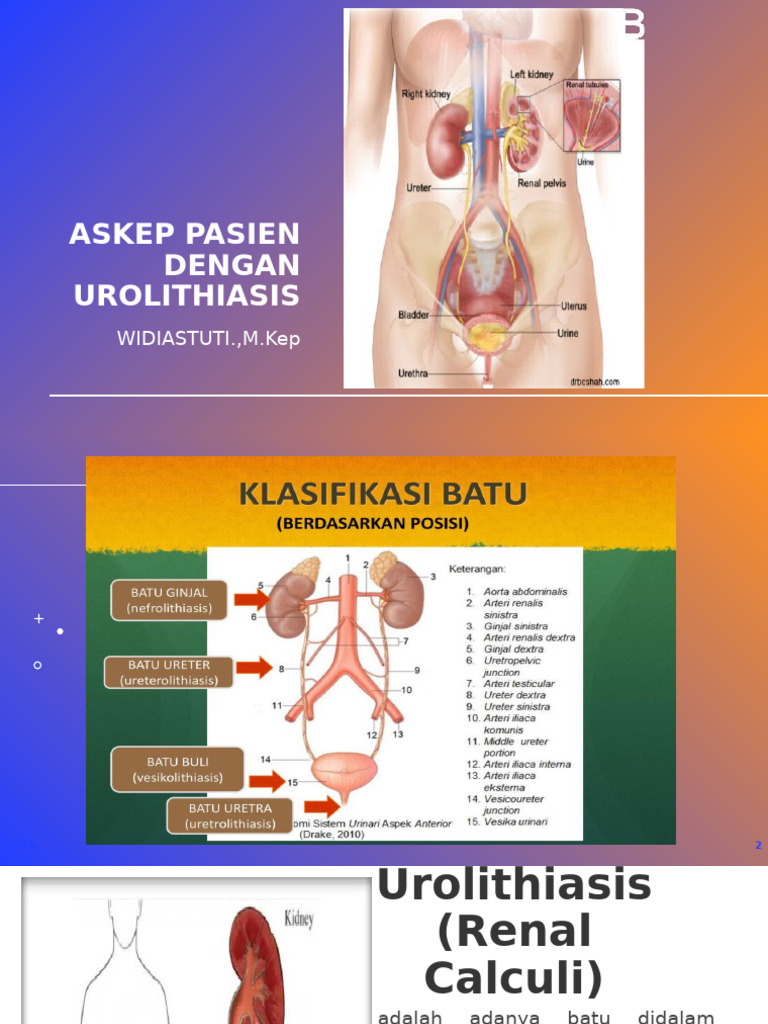 Widi - Askep Pasien Dengan Urolithiasis | PDF