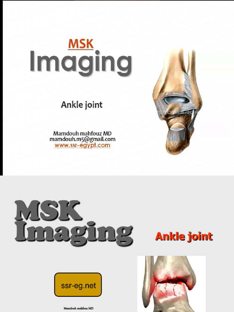 Ankle Joint-D8 | PDF
