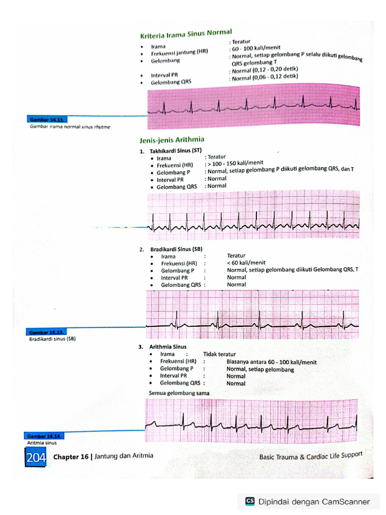 Gelombang Ekg | PDF
