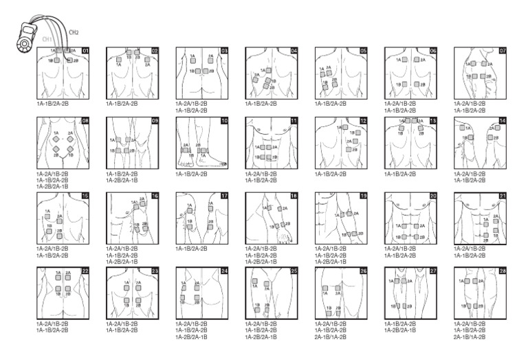posiciones TENS | PDF