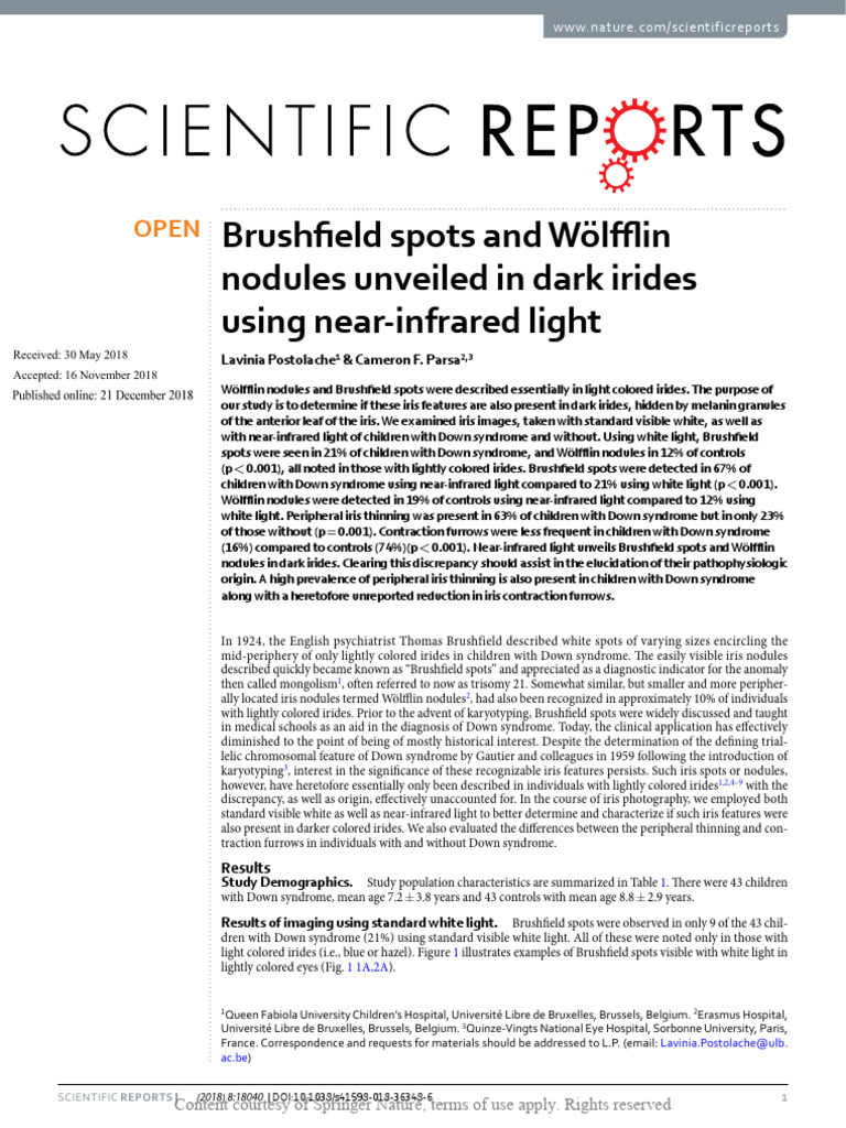 Brushfield Spots and Wolfflin Nodules Unveiled in | PDF