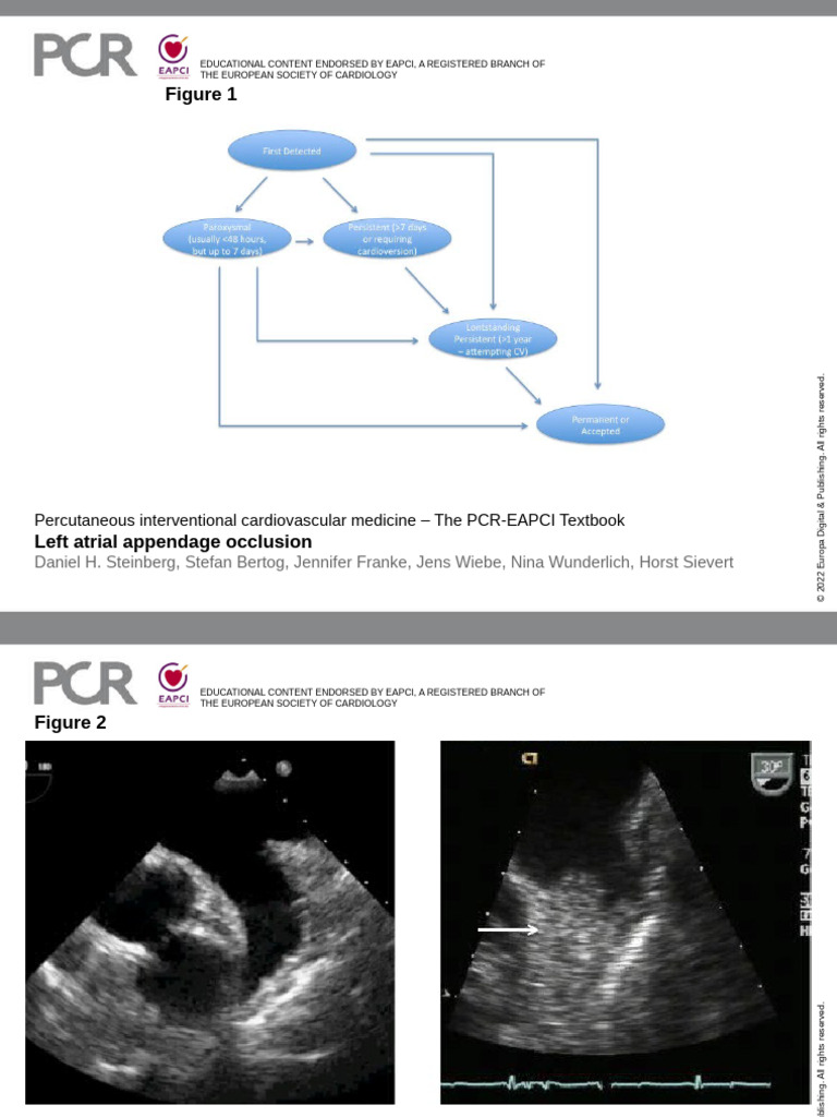 Left Atrial Appendage Occlusion | PDF