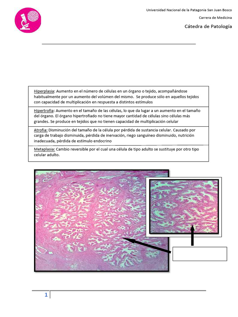 Guía Del TP N°1 Adaptación, Lesión y Muerte Celular | PDF | Apoptosis | P53