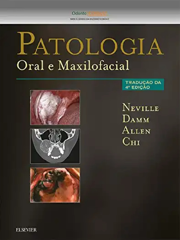 Patologia Oral e Maxilofacial Brad Nevil | PDF