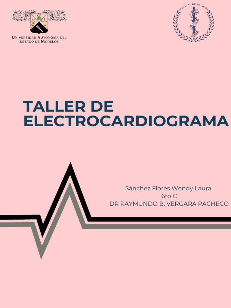 Taller ECG - Sanchez Flores | PDF