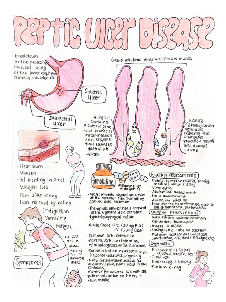 218 Peptic Ulcer Disease one page takeaway | PDF