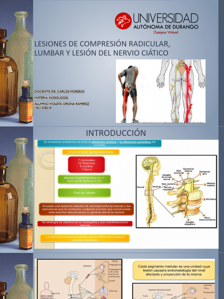 Lesiones de Compresión Radicular, Lumbar y Lesión | PDF | Dolor lumbar ...