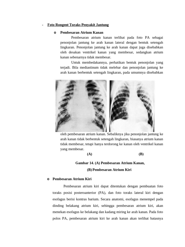 Dasar Teori Pembacaan Ro Thorax 2 | PDF