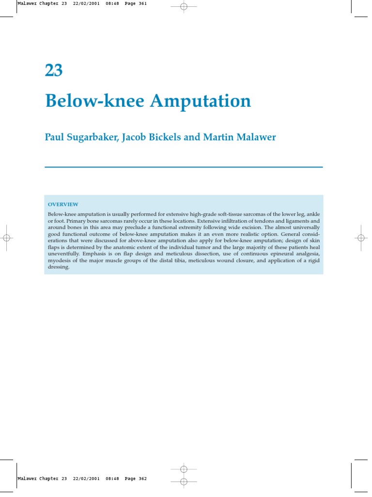 Below Knee Amputation | PDF | Amputation | Prosthesis