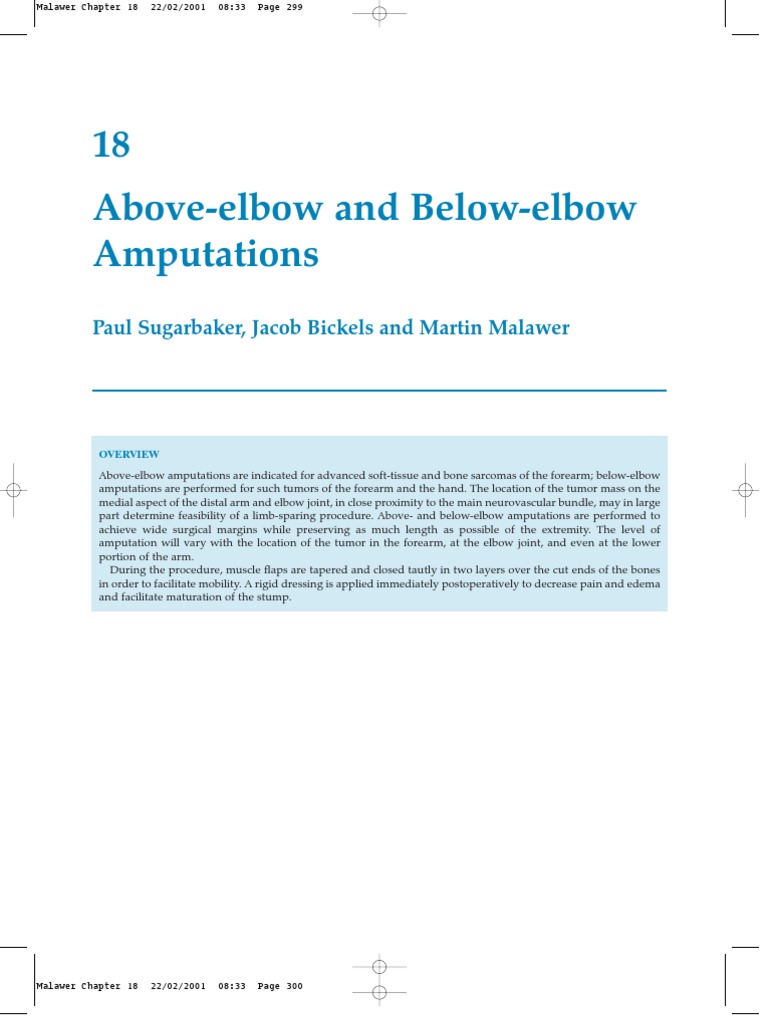 Above Elbow and Below Elbow Amputation | Amputation | Arm