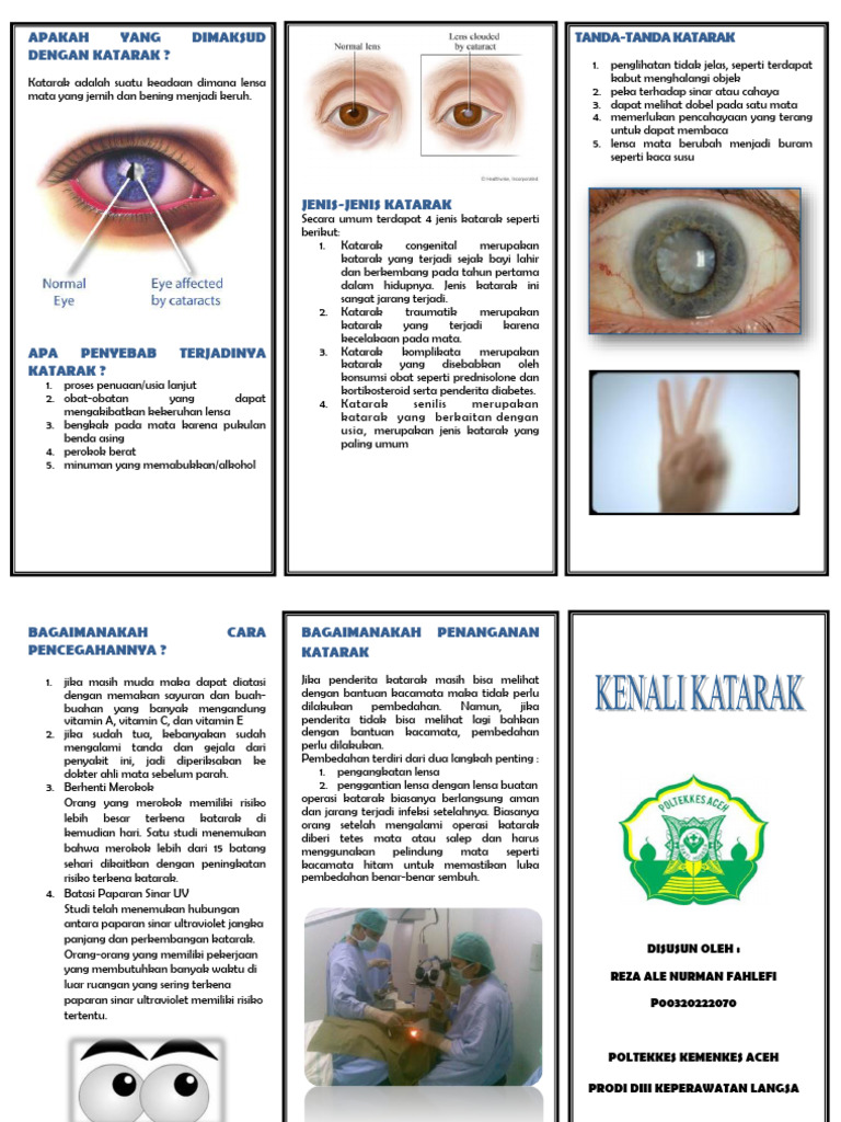 Leaflet Katarak | PDF
