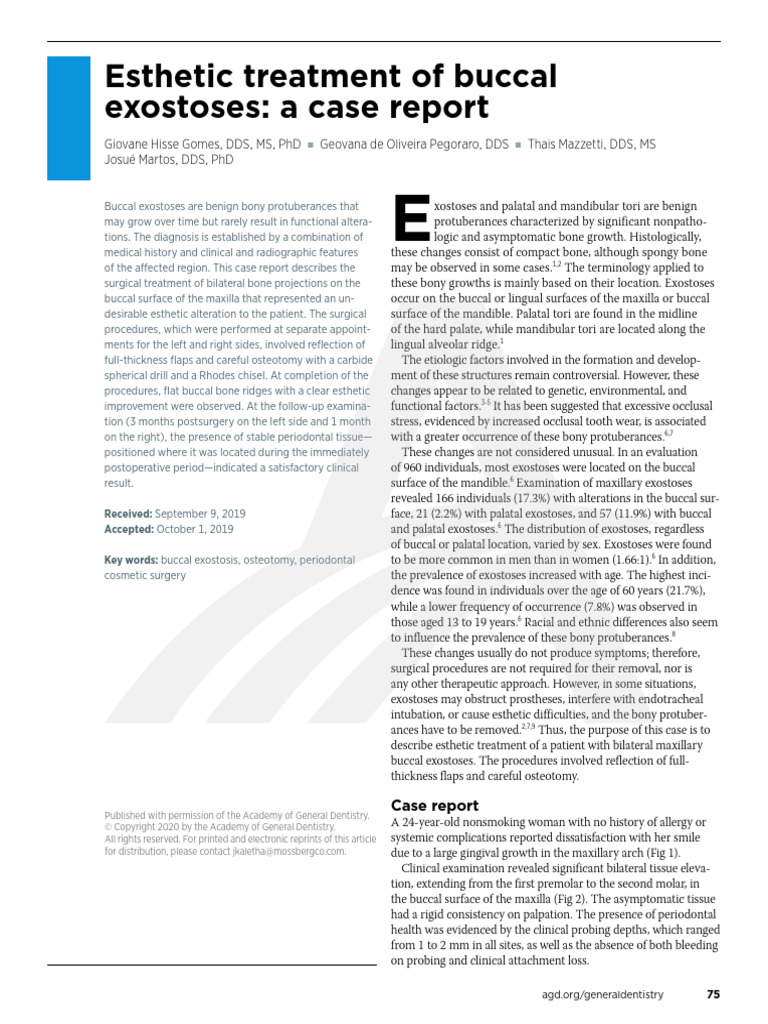 Gendent Nd20 Martos | PDF