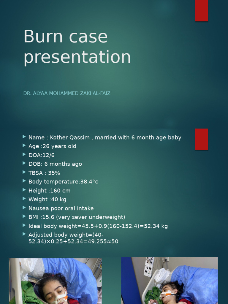 Burn Case Presentation 3 | PDF