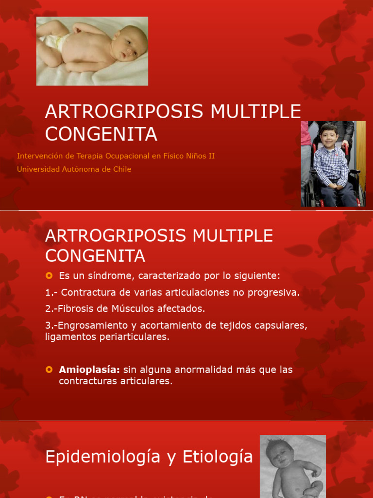 ARTROGRIPOSIS MULTIPLE CONGENITA-Alumnos | PDF