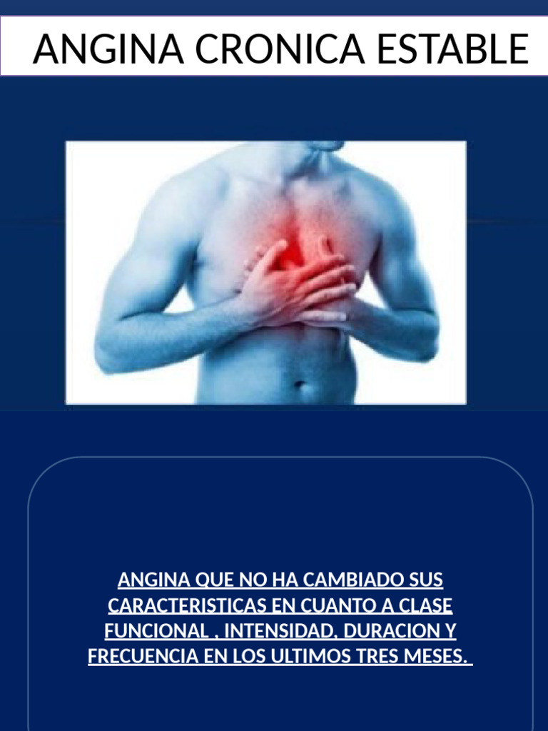 Angina Cronica Estable | PDF