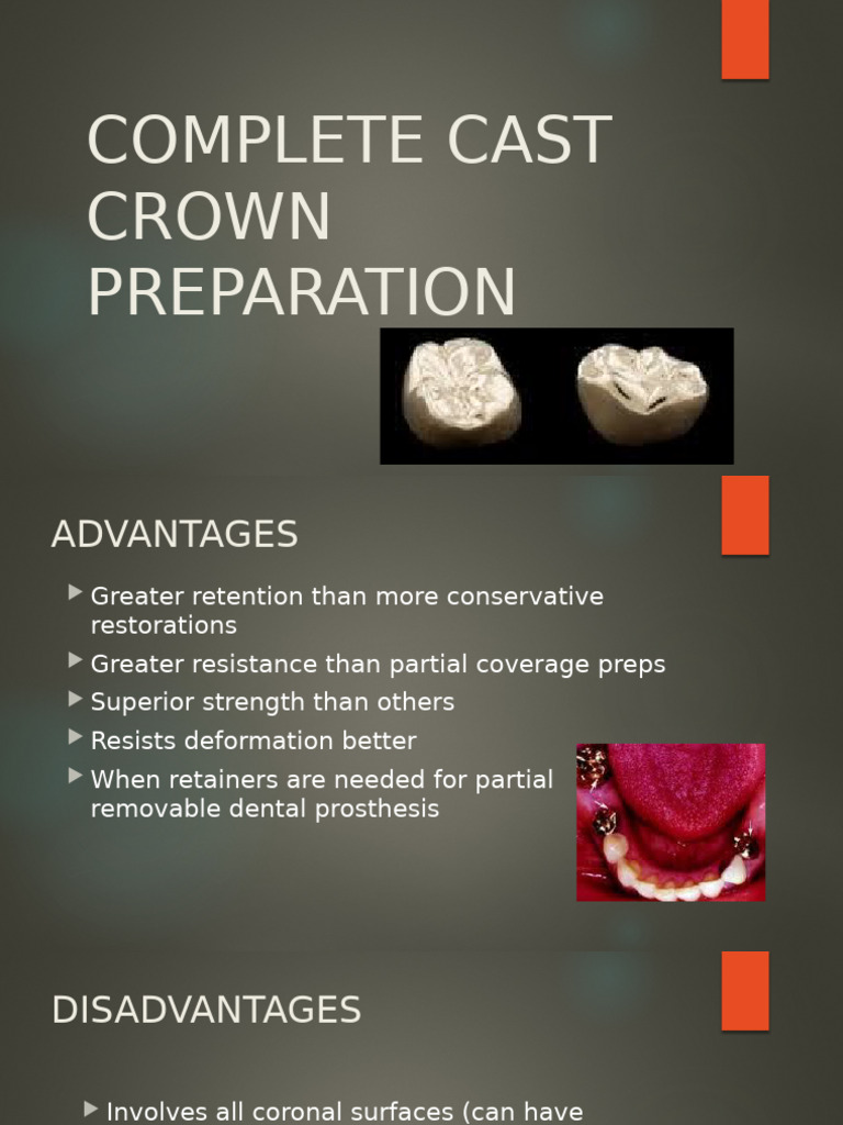 Plete Cast Crown | PDF