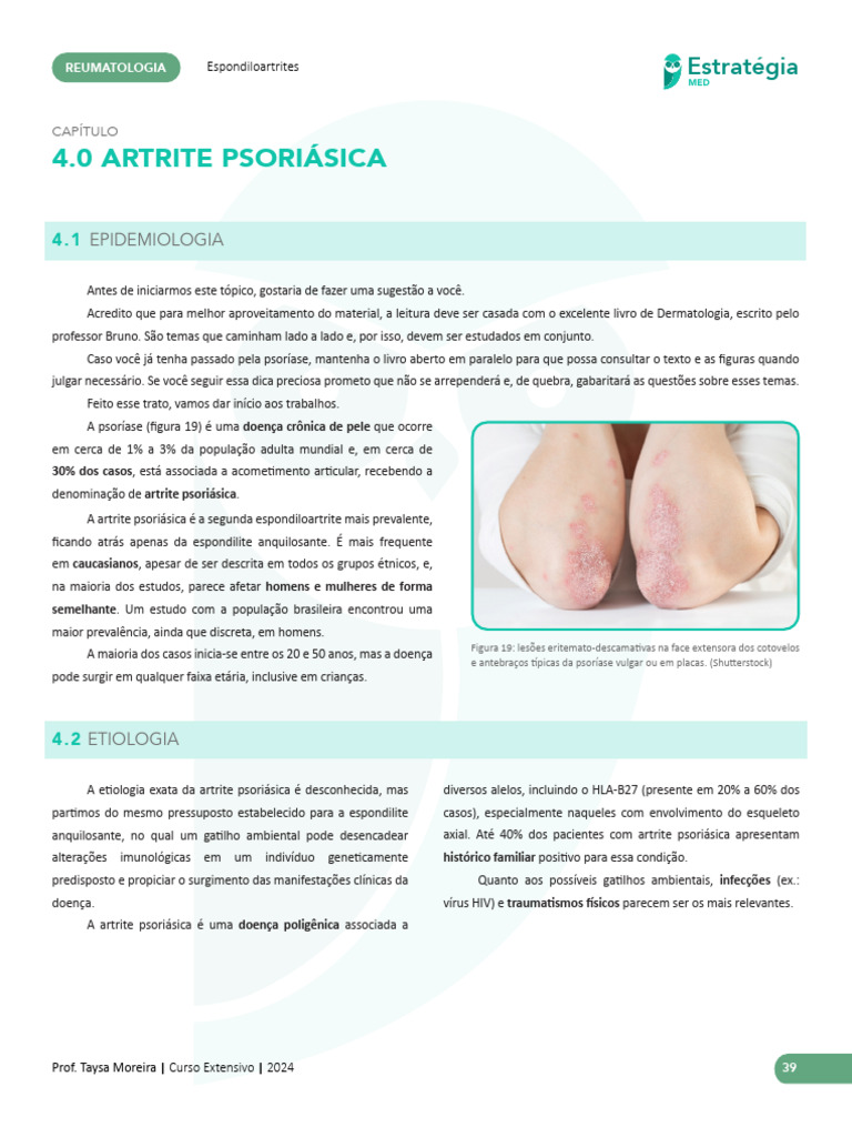 Artrite Psoriásica | PDF